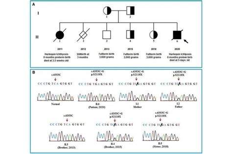 Novel Rare Skin Mutation Gene Identified By Whole Exome Sequencing