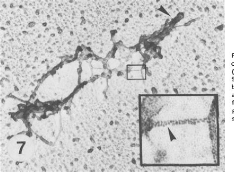 Figure 1 From Filamentous Structures In Adherent Mycoplasma Pneumoniae Cells Treated With