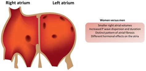 The Pathophysiology Of Sex Differences In Stroke Risk And Prevention In