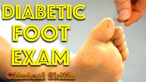Diabetic Foot Examination Clinical Skills Dr Gill YouTube