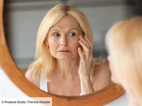 Hyperpigmentation quelle est la différence entre le mélasma et les