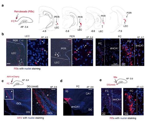 Anatomical Connections Of The Fc A Afferent Regions Of The Fc Download Scientific Diagram