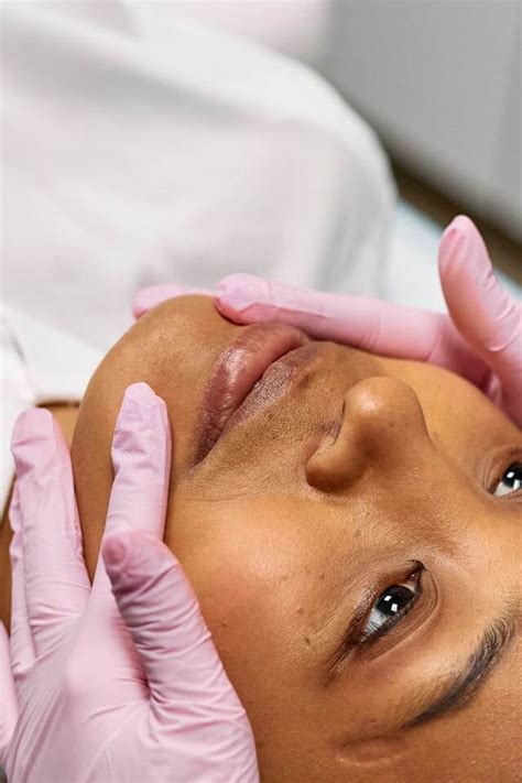 Prp Face New Blossom Medical Aesthetics