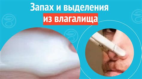 😷 Запах и выделения из влагалища Клинический случай №1142 Youtube