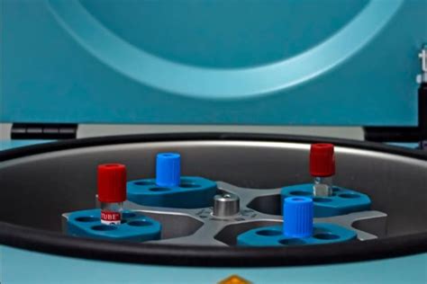 How To Choose The Right Ultracentrifuge For Your Lab