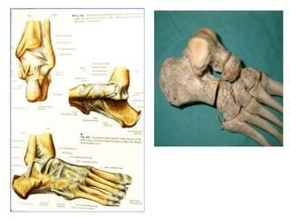 Ankle And Tibiofibular Joint Pptx Ankle And Tibiofibular Joint Pptx