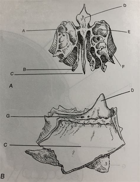 Anterior And Lateral Aspect Of Ethmoid Bone Diagram Quizlet