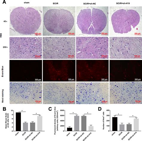 Long Non Coding Rna H19 Contributes To Spinal Cord Ischemiareperfusion