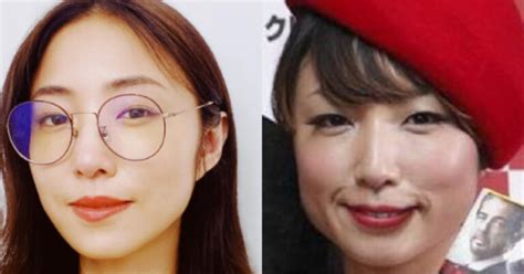 2025最新 Megumi現在の顔が変わった？整形疑惑を若い頃の画像と比較検証してみた！