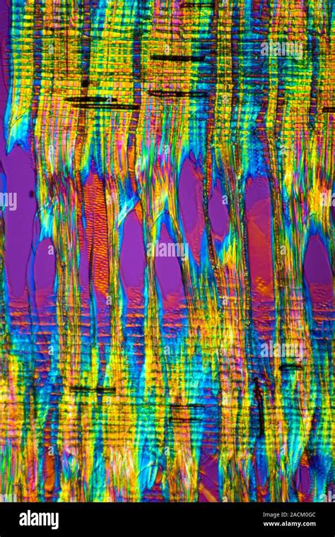 Beech Tree Stem Polarised Light Micrograph Of A Section Through The