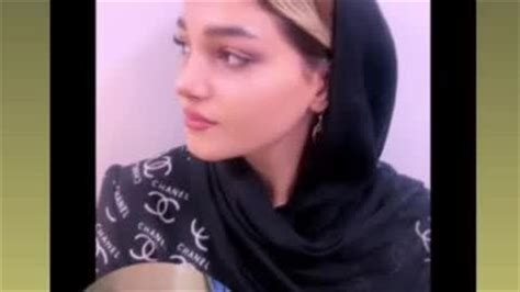 دکتر عارف زاده ، جراح زیبایی بینی و متخصص گوش و حلق و بینی دو ماه بعد