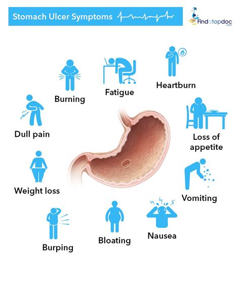 Stomach Ulcer Symptoms Stomach Ulcer Remedies Stomach Ulcers Symptoms Ulcer Symptoms What
