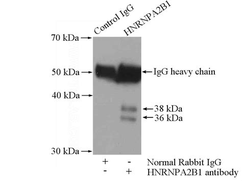 Hnrnpa2b1 Rabbit Polyclonal Antibody