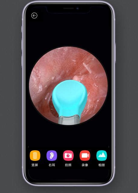 Ушная палочка Bebird M9 Pro Green — купить в интернет-магазине mi-house ...