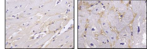 Figure 3 From Role Of Lysyl Oxidase In Myocardial Fibrosis From Basic