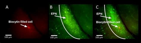 Oxtr Egfp Expressing Neurons In The Endopiriform Nucleus Epn During