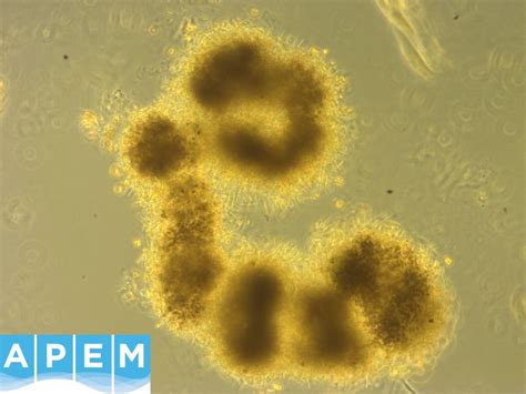 Cyanobacteria Algae Freshwater Lakes Microalgae Apem Group