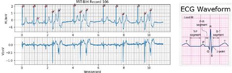 Figure 2 From A Self Contained Stft Cnn For Ecg Classification And