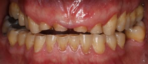 Dental Update Dento Legal Considerations In The Management Of