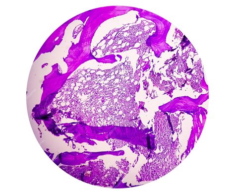 Premium Photo Microscopic Examination Of Thyroglossal Duct Cyst