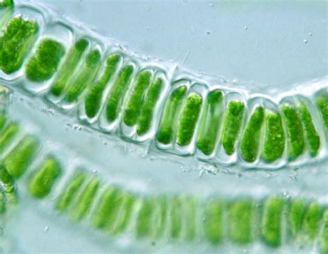 Protist Images Ulothrix