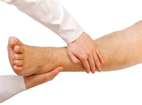 Symptoms And Causes Of Phlebitis With Risk Factors