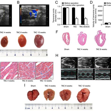 Color Doppler Ultrasound Imaging From The Aortic Arch Of A Ligated