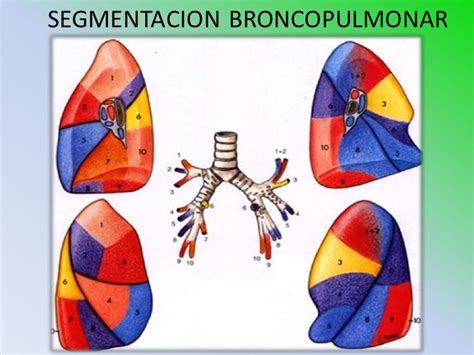 Segmentación Broncopulmonar Diagnostico Por Imagenes Medio De