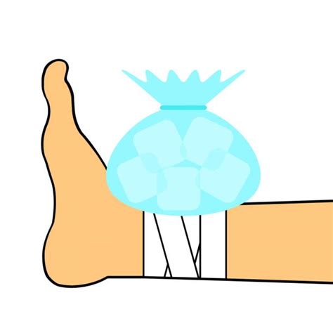 Top 60 Ankle Sprain Clip Art Vector Graphics And Illustrations Istock
