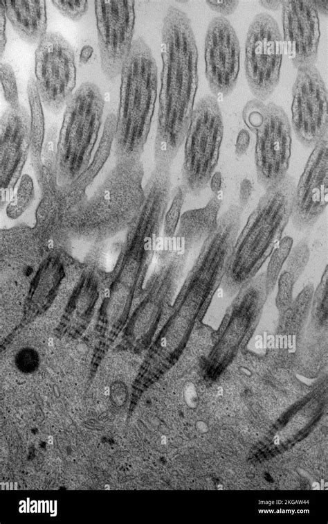 Transmission Electron Micrograph Tem Of A Section Through Respiratory Epithelium In The Upper