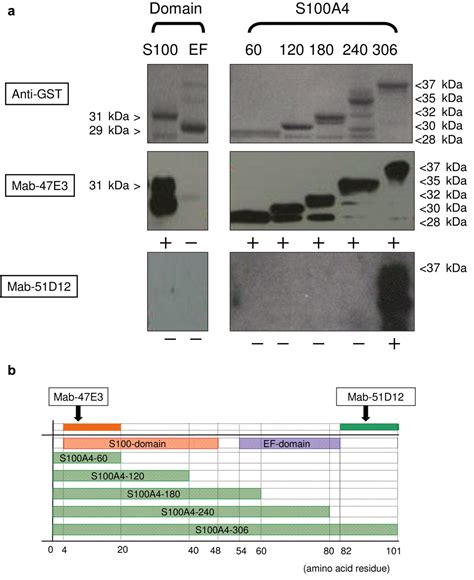 Significance Of S A As A Prognostic Marker Of Lung Squamous Cell Carcinoma Anticancer Research