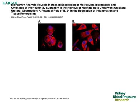 Microarray Analysis Reveals Increased Expression Of Matrix