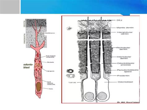 Dentin Hypersensitivity Pptx