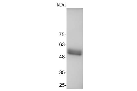 SARS CoV 2 Spike Protein RBD His SUMO Tag HEK293 Croyez Biomol