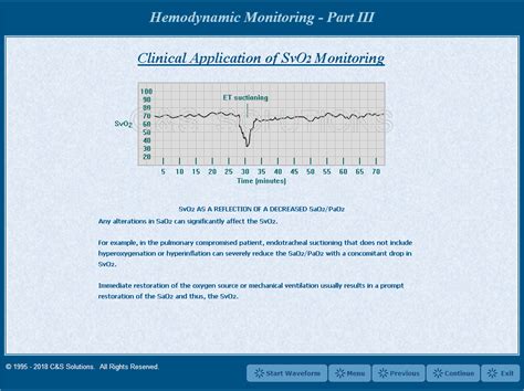 Hemodynamic Monitoring Part Iii Screen Shots