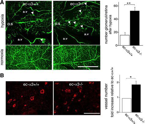 Figure 2 From Vascular Biology Atherosclerosis And Endothelium Biology Endothelial 3 1