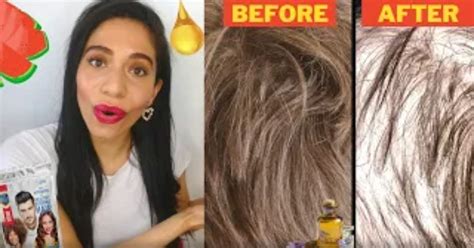 Natural Dht Blockers For Hair Loss Mega Video Scalp Scrub The Best Foods Natural Oils