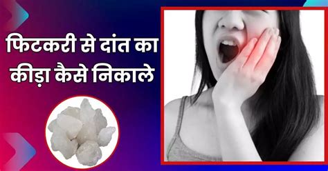 फिटकरी से दांत का कीड़ा कैसे निकाले सिर्फ 1 मिनट में राहत मिलेगी