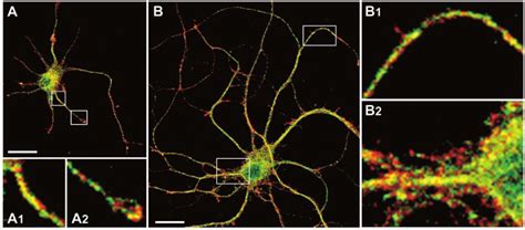 Dynamin And Phocein Partially Co Localize In Cultured Hippocampal