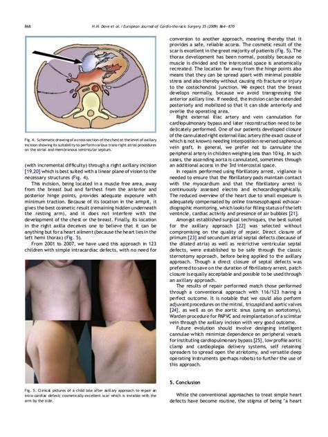 Axillary Repair Of Chd