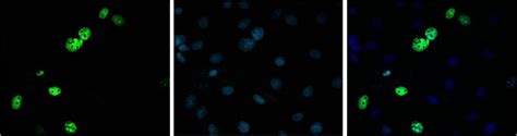 Iclick™ Eu Andy Fluor™ 488 Imaging Kit Abp Biosciences