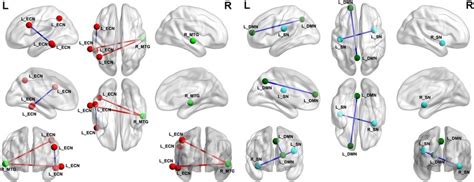 A Holistic View Of Seed Based Functional Connectivity Differences In