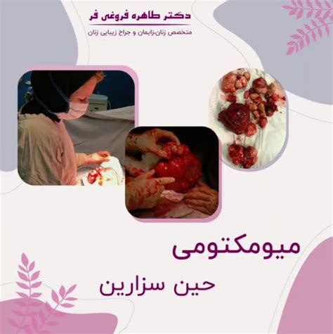 نمونه کارهای دکتر طاهره فروغی فر فلوشیپ فوق تخصصی زنان