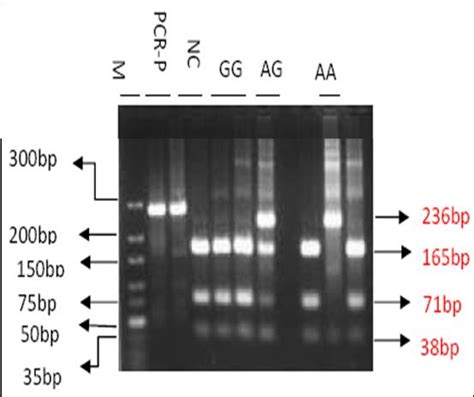 Digestion Of Pcr Product With Sdu1 Restriction Enzyme Lane M Contains Download Scientific