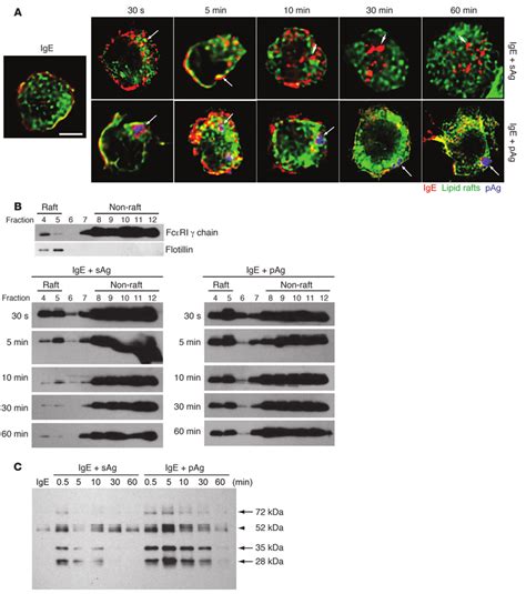 IgE FcεRI complexes are retained within lipid raft enriched domains of Download Scientific