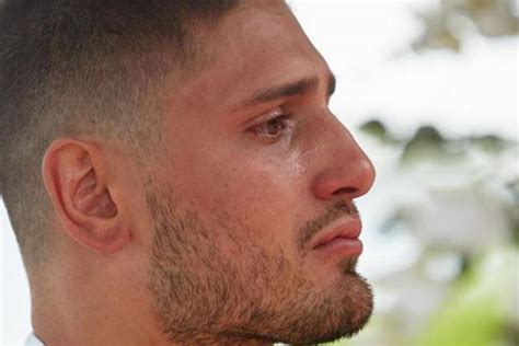 Ator Daniel Rocha Passa Por Cirurgia Facial E Antes E Depois Assusta