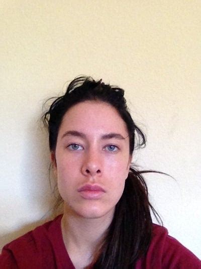 What Cosmetic Procedure Treatment Would You Recommend To Make My Face Prettier And Less