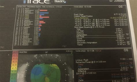 Do I Have Higher Order Aberrations R Keratoconus