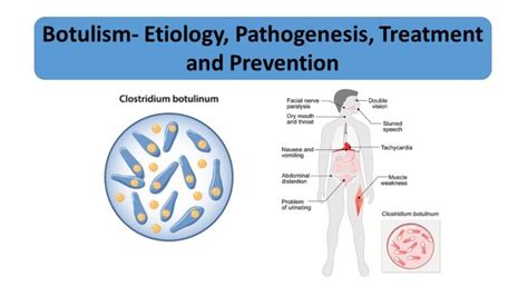 Clostridium Botulinum Disease Microbiology Notes