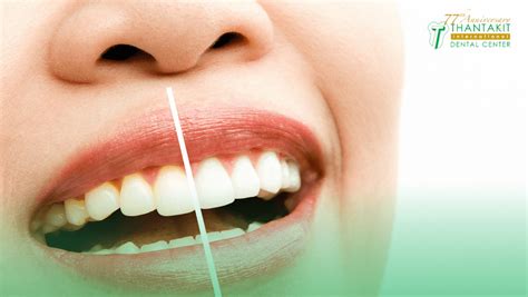 The Importance Of Regular Dental Checkups